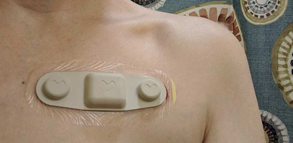 VivaLNK Vital Scout continuous wellness monitor review - The Gadgeteer