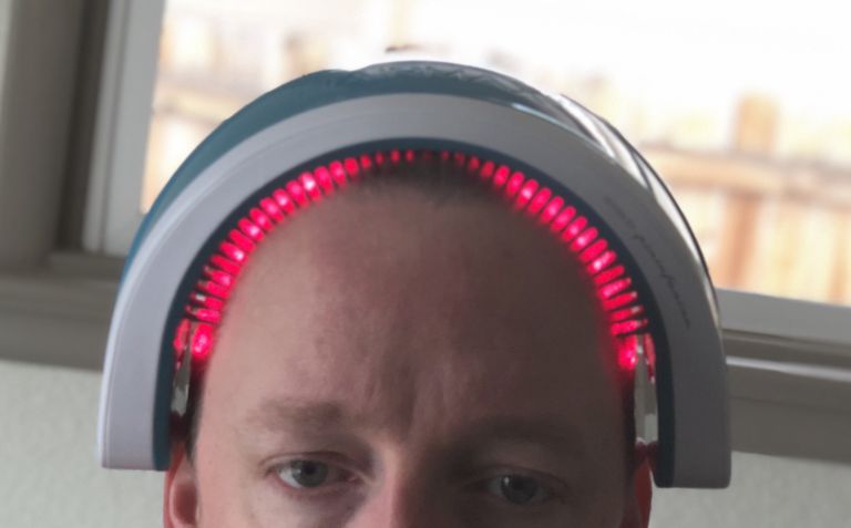 Hairmax LaserBand 82 hair growth laser light device review - The Gadgeteer