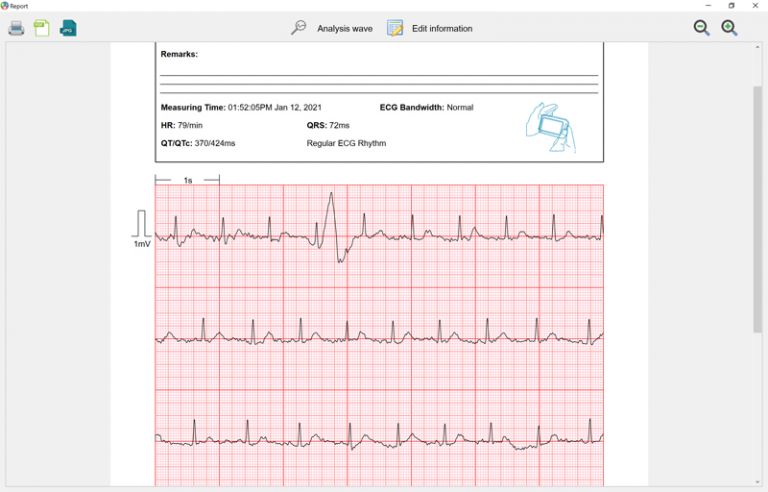 Wellue Checkme Pro health monitor review - The Gadgeteer