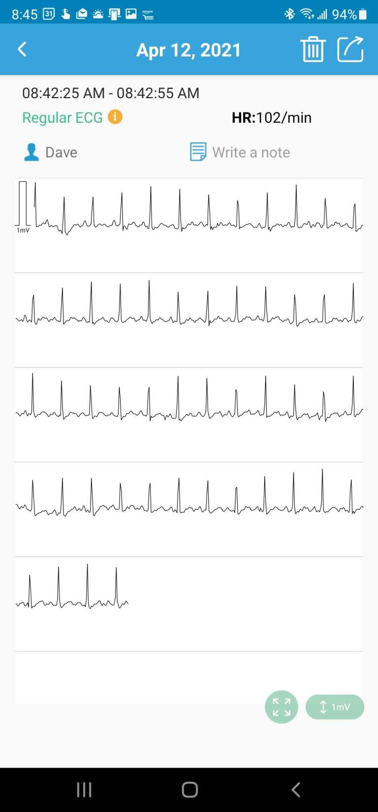 Wellue Blood Pressure/EKG Monitor review - Keep calm but monitor on ...