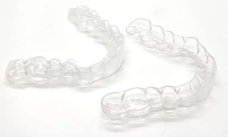 Remi custom night guard home kit review - end the daily grind - The ...