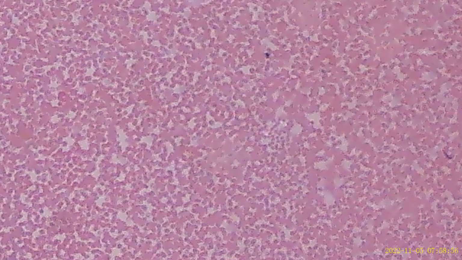 Apexel APL-MS003 digital microscope kit review - The Gadgeteer