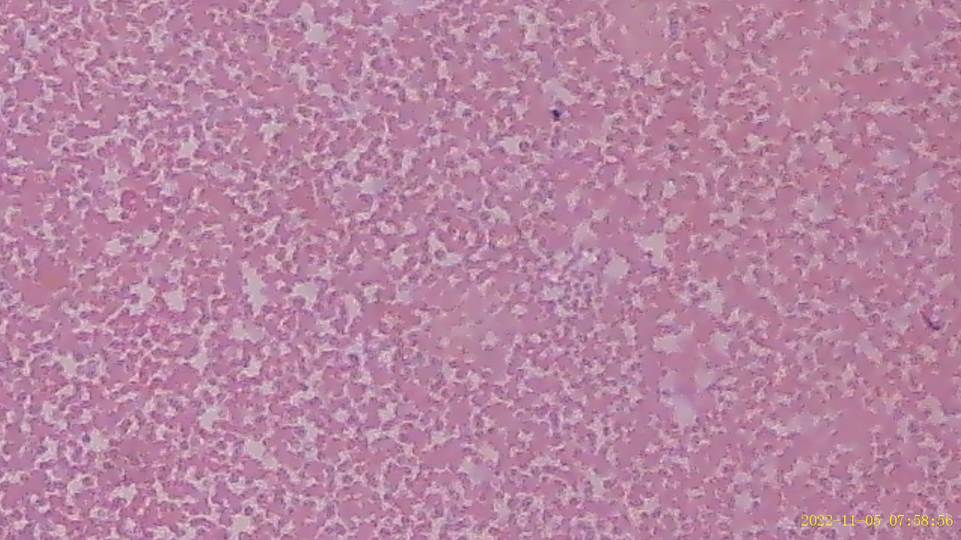 Apexel APL-MS003 digital microscope kit review - The Gadgeteer