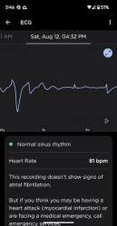 Withings ScanWatch review - Smart and classy smartwatch without ...