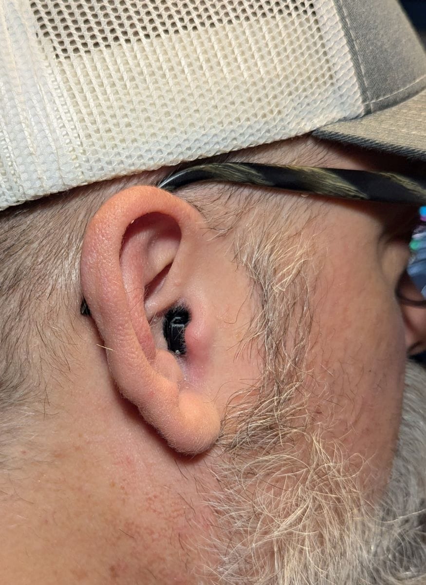 Sony CRE C-10 Self-fitting OTC hearing aids review - Is this the answer ...